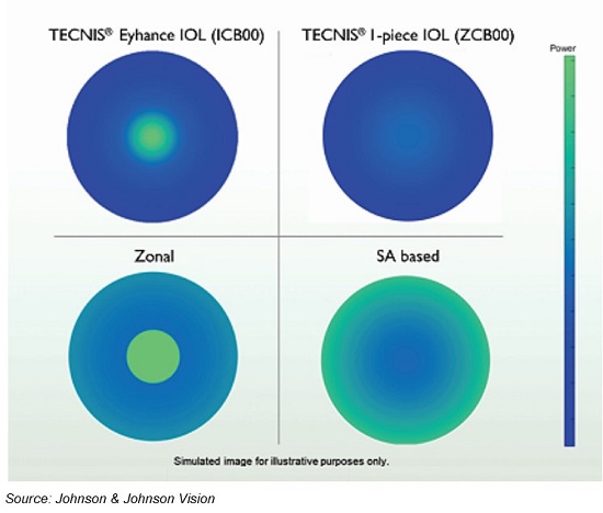 J&J Vision’s Eyhance is First Monofocal IOL Optimized for Intermediate ...
