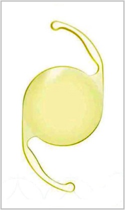 Alcon Launches US IOL Portfolio in Clareon Material | Market Scope