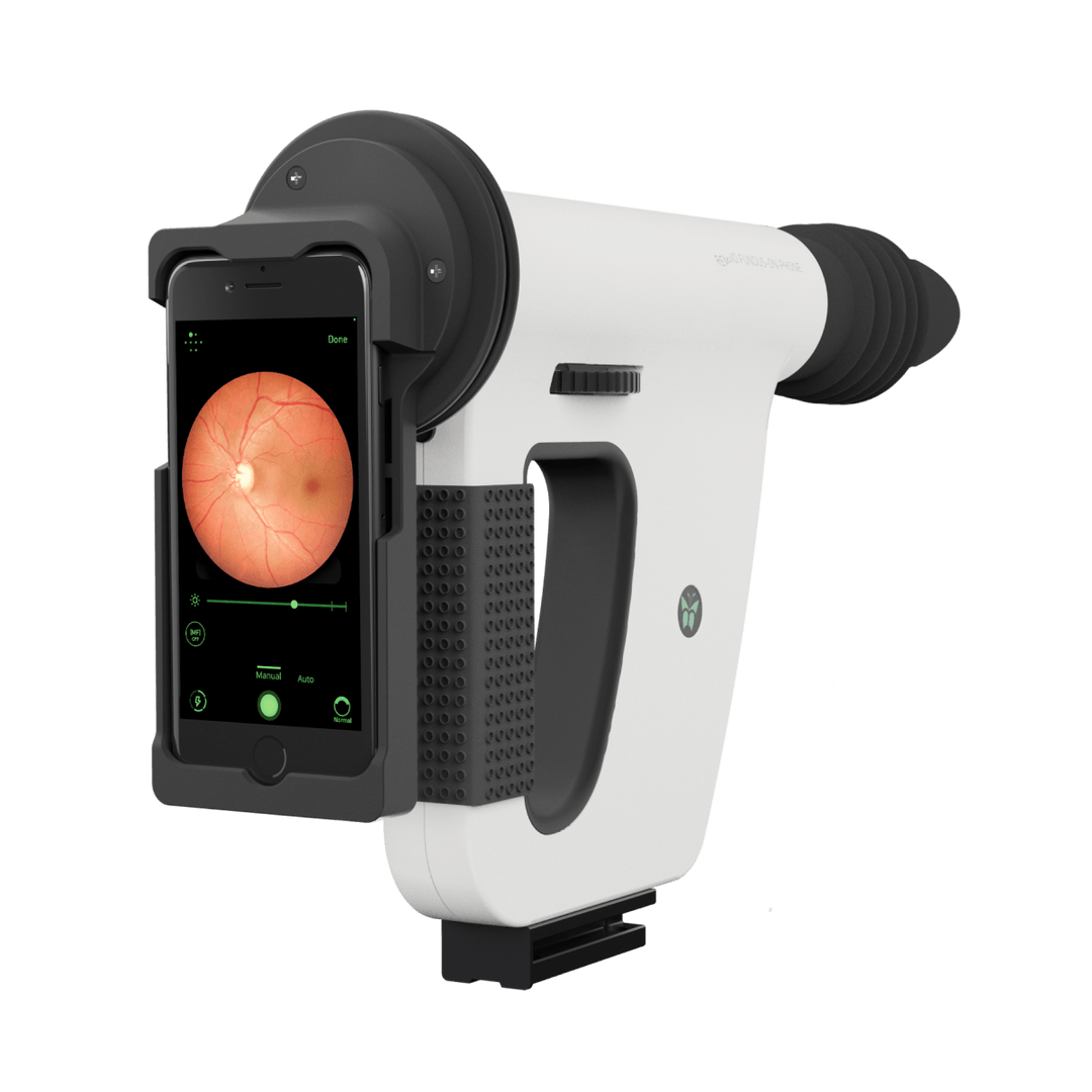 Remidio’s Medios AI for Smartphone DR Screening System Receives CE Mark ...